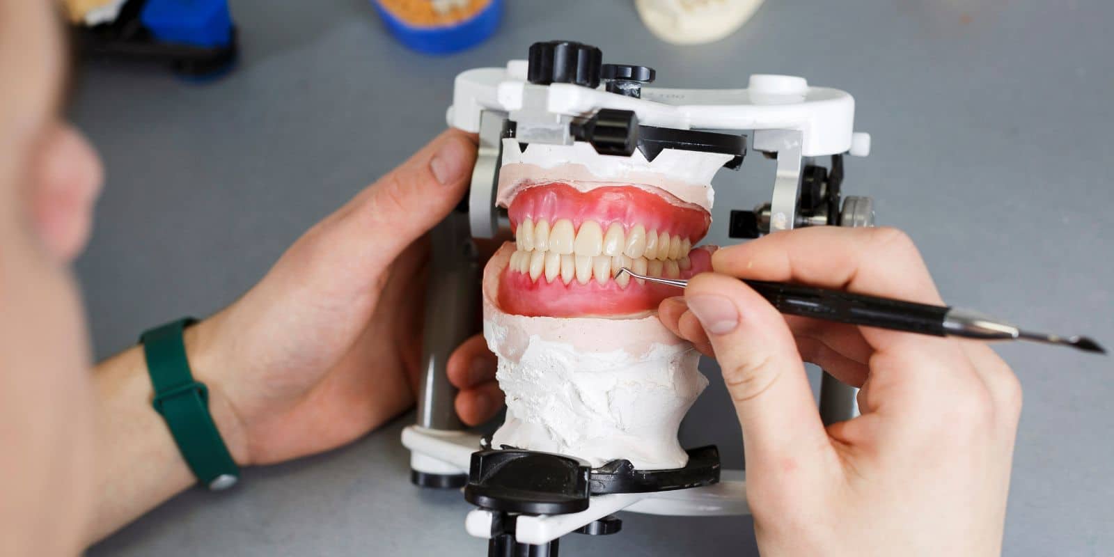 Tipos de Prótesis Dental Fija: Una Guía Completa - midentista Valencia